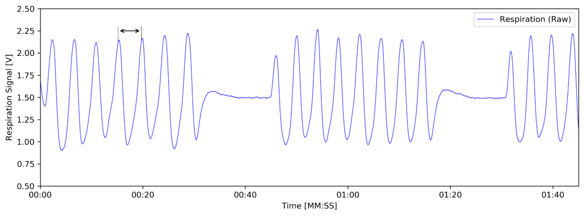 How can I identify Apnea Phases using Inductive Respiration (RIP ...