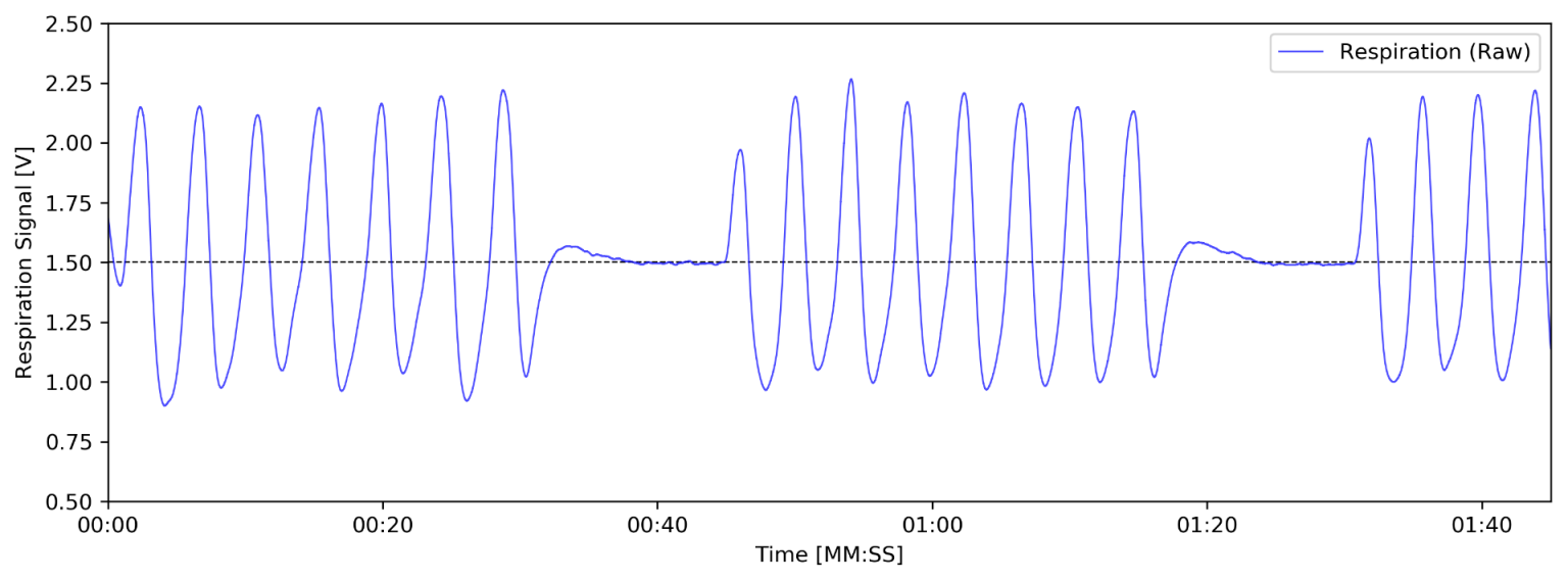 How can I identify Apnea Phases using Inductive Respiration (RIP ...
