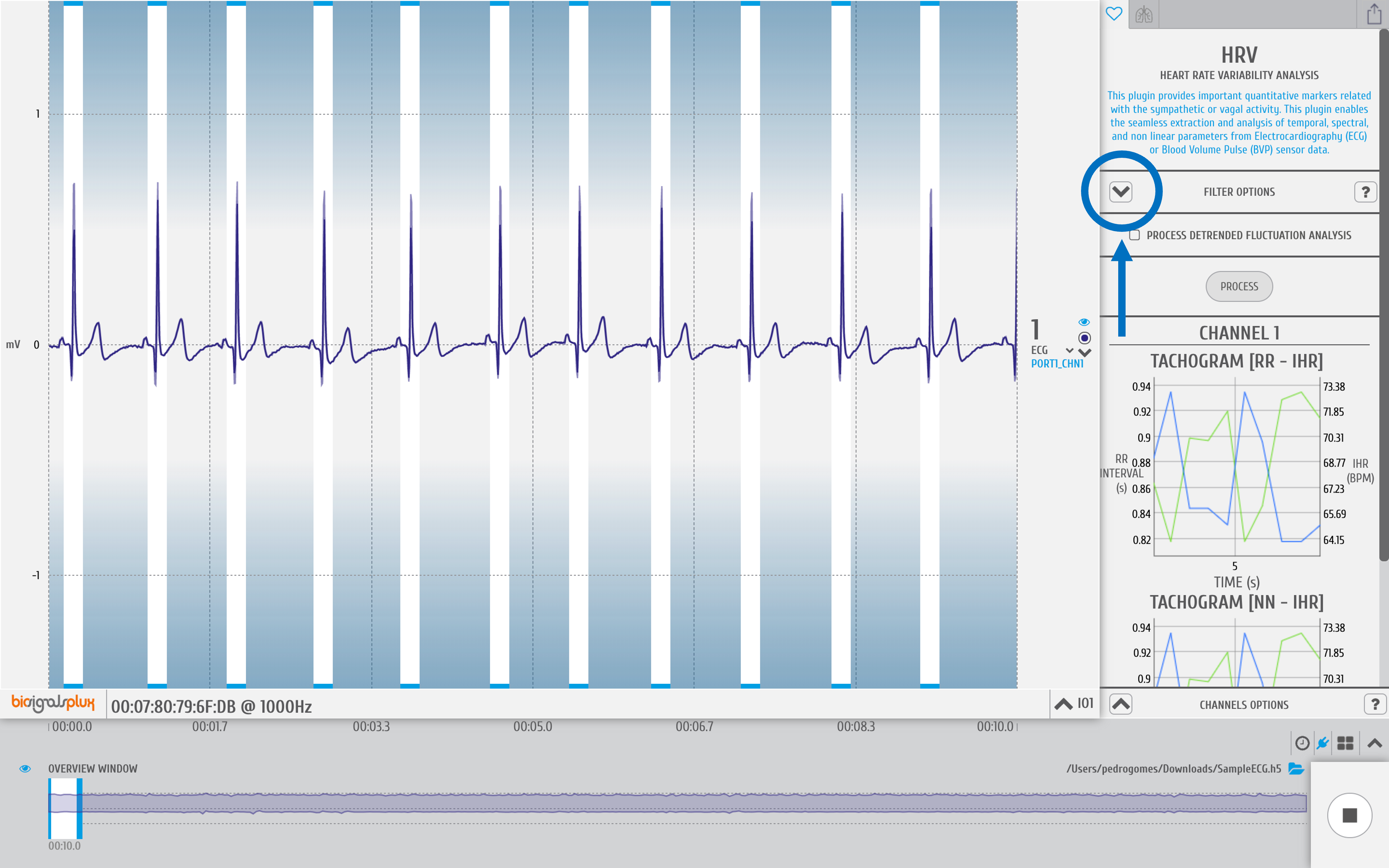 Which values define a good starting point for the HRV add-on’s “Filter ...