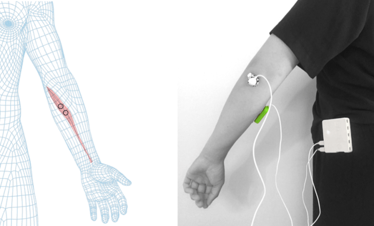 Where should I place my Electromyography (EMG) electrodes?