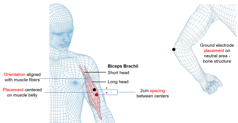 Where should I place my Electromyography (EMG) electrodes?