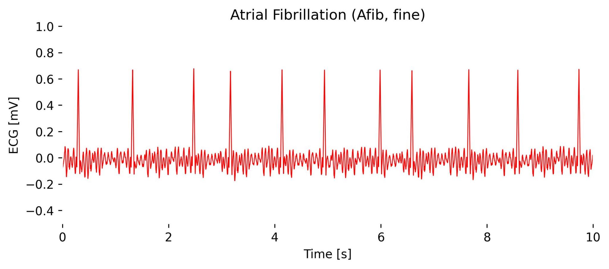 cardioBAN BLE: Sample Signals
