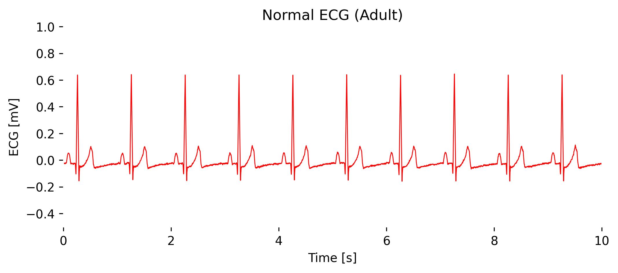cardioBAN BLE: Sample Signals – Support PLUX Biosignals official