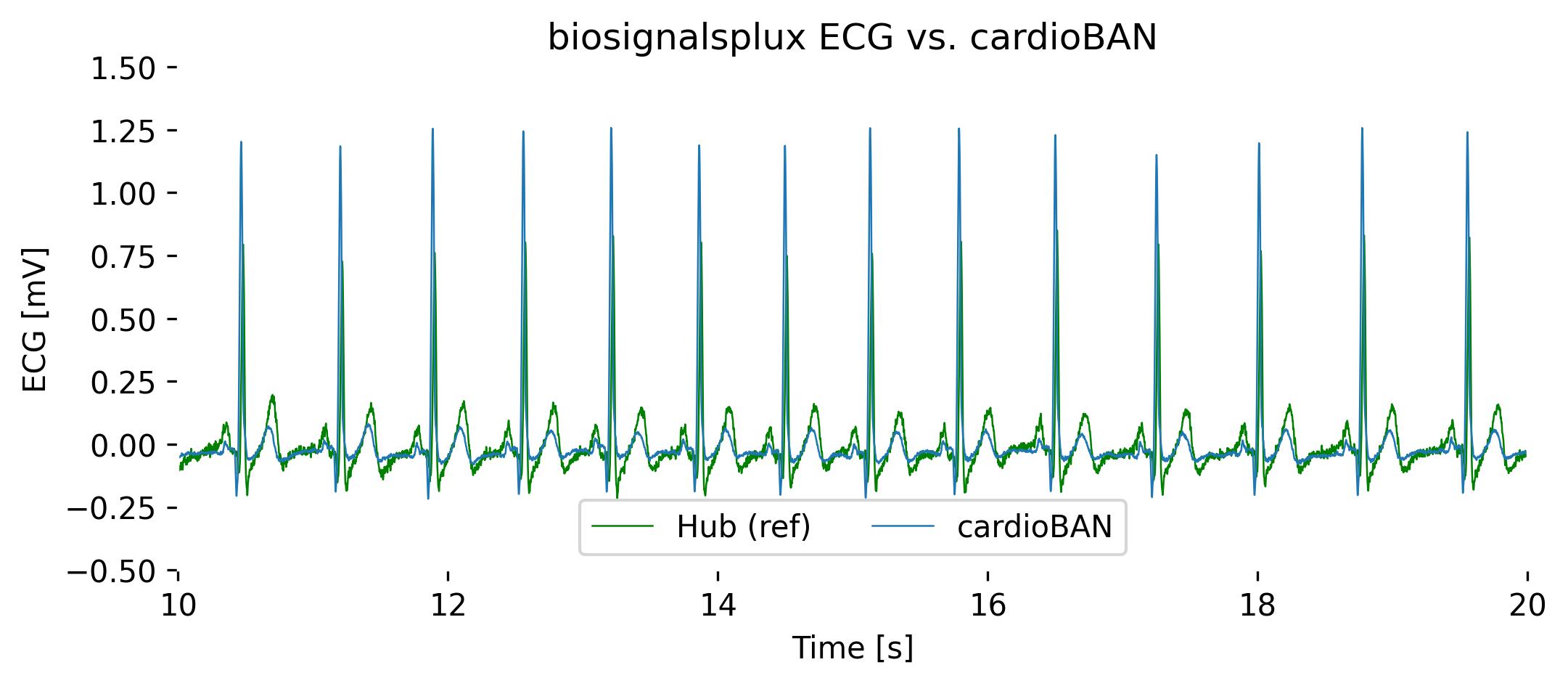cardioBAN BLE: Sample Signals – Support PLUX Biosignals official