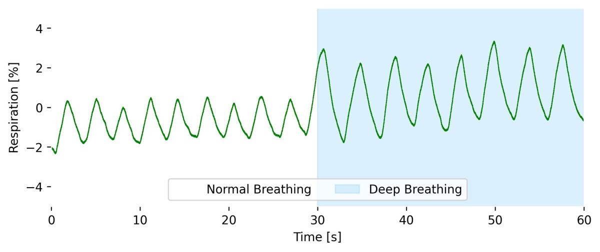 respiBAN BLE: Sample Signals