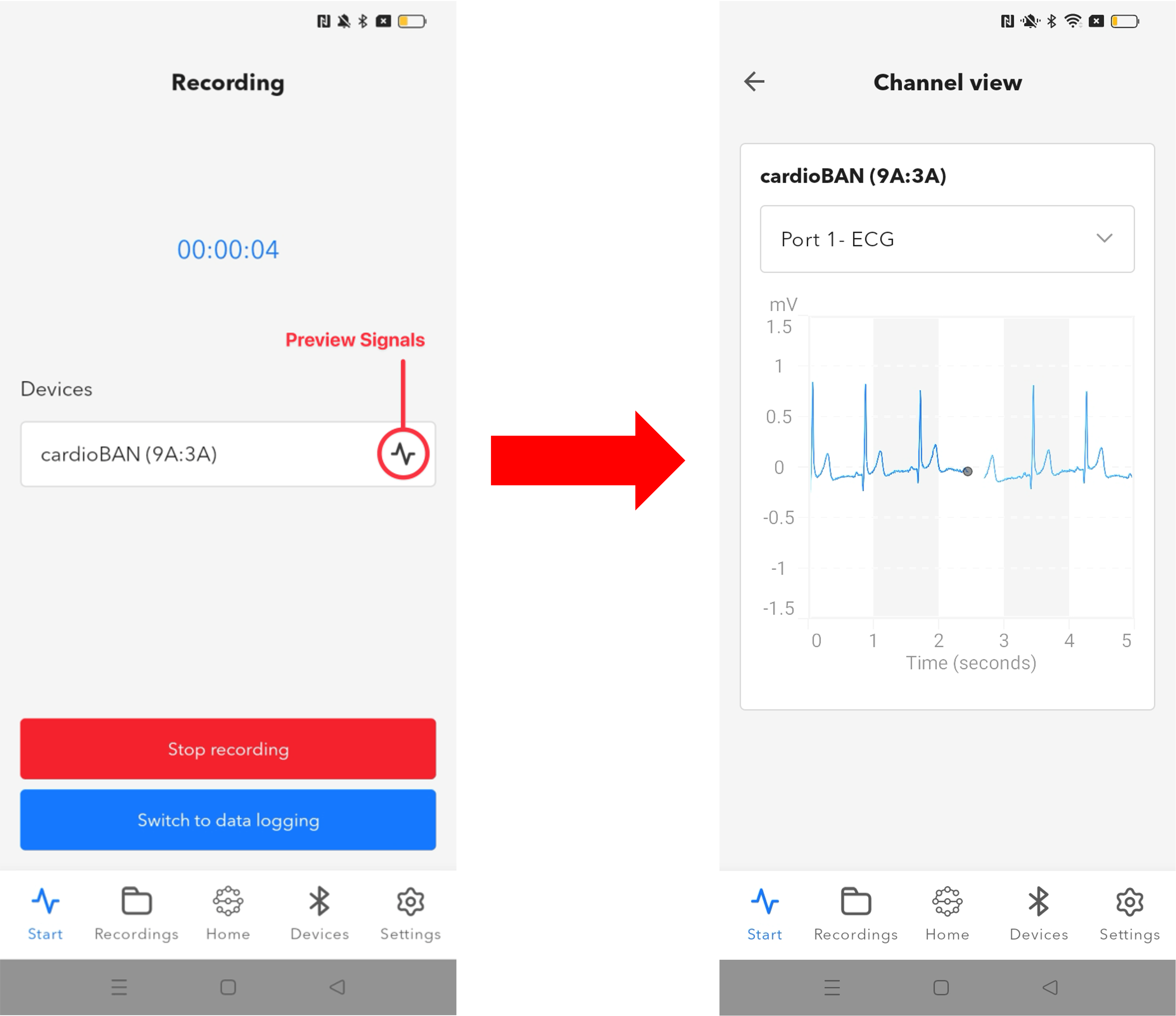 Biosignals Studio: How do I record signals? – Support PLUX Biosignals ...